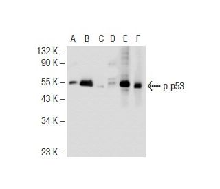 p-p53 Antibody (Ser 392) | SCBT - Santa Cruz Biotechnology