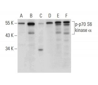 Anti-p-p70 S6 kinase α Antibody (A-6) | SCBT - Santa Cruz Biotechnology