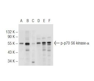 Anti-p-p70 S6 kinase α Antibody (A-6) | SCBT - Santa Cruz Biotechnology