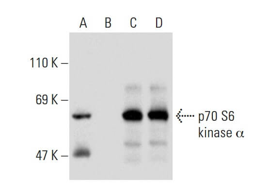 p-p70 S6 kinase α Antibody (A-6) | SCBT - Santa Cruz Biotechnology