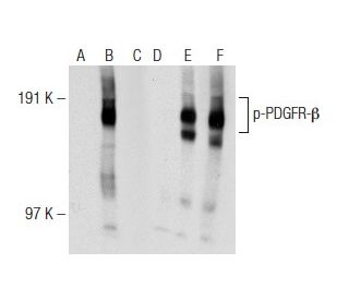 p-PDGFR-β Antibody (F-10) - Western Blotting - Image 141663