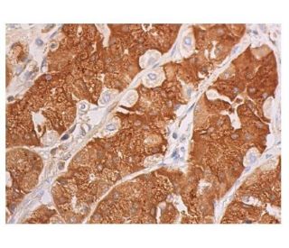 p-PKC α Antibody (A-11) - Immunohistochemistry - Image 352339