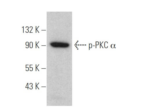Anti-p-PKC α Antibody (A-11) | SCBT - Santa Cruz Biotechnology
