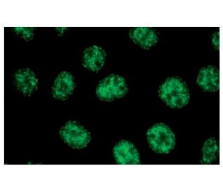 Anti-p-Pol II Antibody (8A7) | SCBT - Santa Cruz Biotechnology