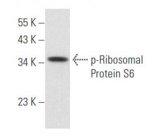p-Ribosomal Protein S6 Antibody (50.Ser 235/236) - Western Blotting ...