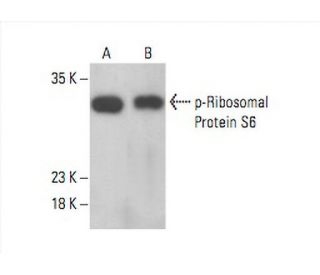 p-Ribosomal Protein S6 Antibody (50.Ser 235/236) - Western Blotting - Image 392843