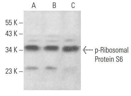 p-Ribosomal Protein S6 Antibody (B-6) | SCBT - Santa Cruz Biotechnology