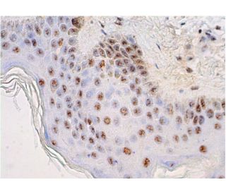 Anti-p-SC35 Antibody (SC-35) | SCBT - Santa Cruz Biotechnology