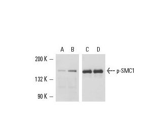 p-SMC1 Antibody (5D11G5) | SCBT - Santa Cruz Biotechnology