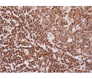 p-SMC1 Antibody (5D11G5) | SCBT - Santa Cruz Biotechnology