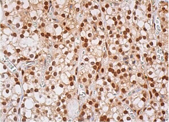 p-SMC1 Antibody (5D11G5) | SCBT - Santa Cruz Biotechnology