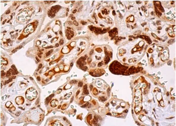 p-SMC1 Antibody (5D11G5) | SCBT - Santa Cruz Biotechnology