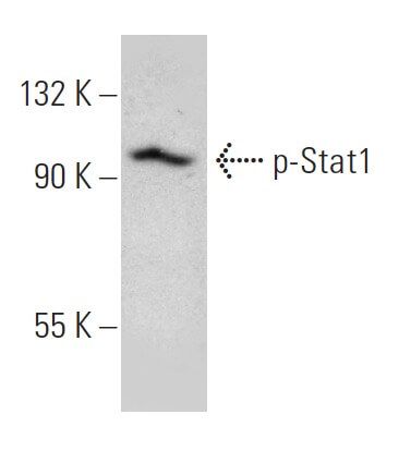 p-Stat1抗体 (PSM1) | SCBT - Santa Cruz Biotechnology