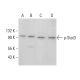 p-Stat3 Antibody (B-7) | SCBT - Santa Cruz Biotechnology
