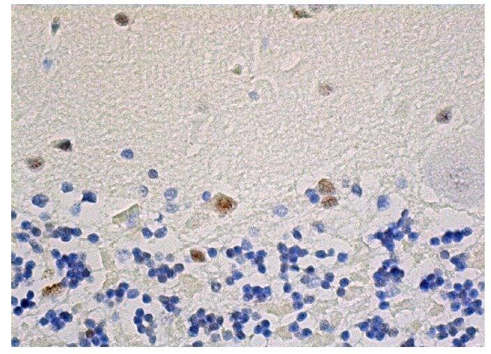 p-Tau Antibody (PHF-6) | SCBT - Santa Cruz Biotechnology