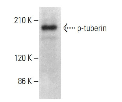 p-tuberin Antibody (325.Ser 1798) | SCBT - Santa Cruz Biotechnology
