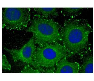 p-Tyr Antibody (PY99) - Immunofluorescence - Image 352516