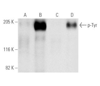 p-Tyr Antibody (PY99) - Western Blotting - Image 5572