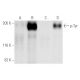 Phosphotyrosine抗体 (PY99) | SCBT - Santa Cruz Biotechnology