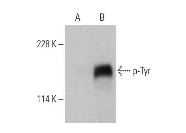Anti-p-Tyr Antibody (PY99) | SCBT - Santa Cruz Biotechnology