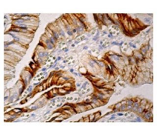 p120 Antibody (15D2) | SCBT - Santa Cruz Biotechnology