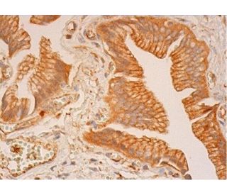 p120 Antibody (6H11) | SCBT - Santa Cruz Biotechnology