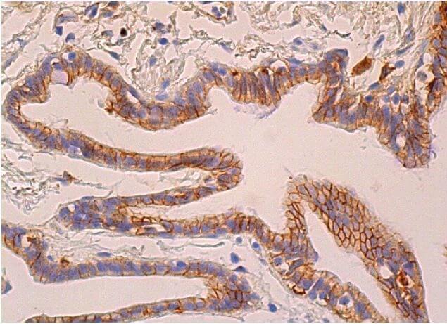 p120 Antibody (6H11) | SCBT - Santa Cruz Biotechnology