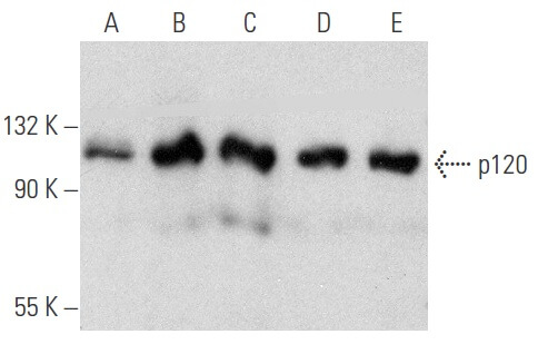 p120 Antibody (6H11) | SCBT - Santa Cruz Biotechnology