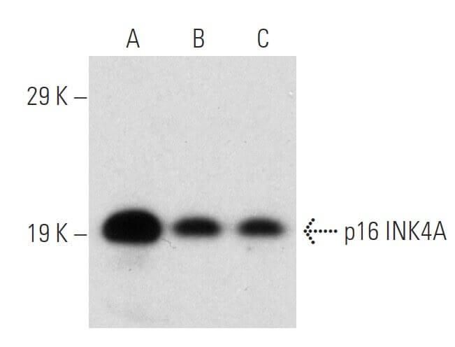 CDKN2A/p16 Antibody (50.1) | SCBT - Santa Cruz Biotechnology