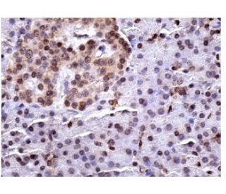 p16 INK4A Antibody (F-12) - Immunohistochemistry - Image 156601