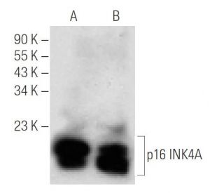 p16 INK4A Antibody (F-12) - Western Blotting - Image 164438