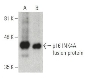 p16 INK4A Antibody (F-12) - Western Blotting - Image 396351