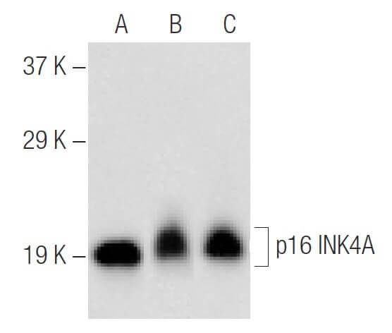 CDKN2A/p16 Antibody (F-4) | SCBT - Santa Cruz Biotechnology