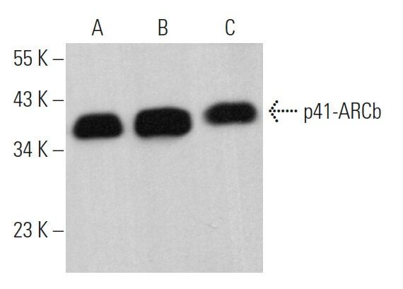 p41-ARCb Antibody (H-1) | SCBT - Santa Cruz Biotechnology
