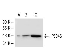 Anti-P504S Antibody (2A10F3) | SCBT - Santa Cruz Biotechnology
