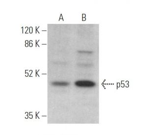 p53 Antibody (A-1) - Western Blotting - Image 373964