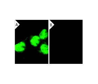 p53 siRNA (h): sc-29435. Immunofluorescence staining of methanol-fixed ...