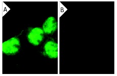 p53 siRNA (h), shRNA and Lentiviral Particle Gene Silencers | SCBT ...
