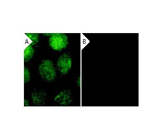 p53 siRNA (h): sc-29435. Immunofluorescence staining of methanol-fixed ...