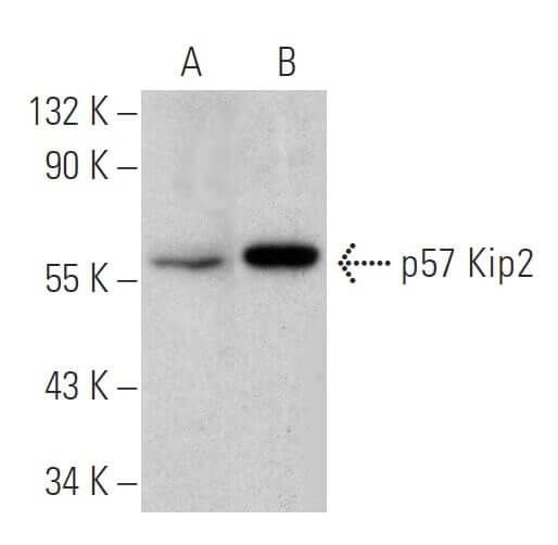p57 Kip2 Antibody (3F244) | SCBT - Santa Cruz Biotechnology