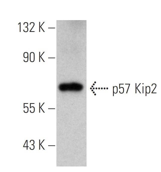 p57 Kip2 Antibody (3F245) | SCBT - Santa Cruz Biotechnology