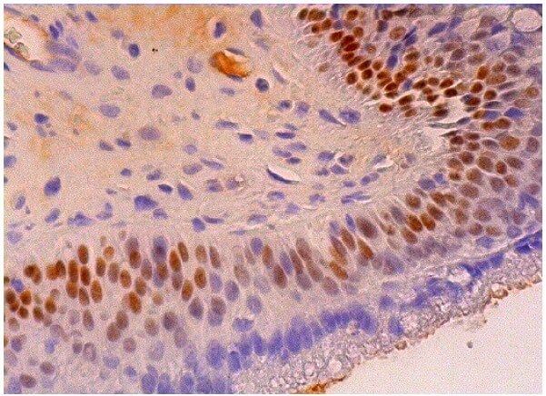 Anti-p63 Antibody (D-9) | SCBT - Santa Cruz Biotechnology