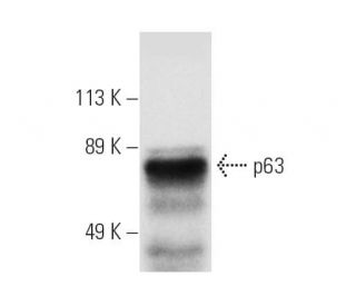 p63 Antibody (D-9) - Western Blotting - Image 22