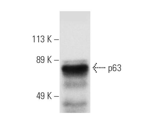 Anti-p63 Antibody (D-9) | SCBT - Santa Cruz Biotechnology