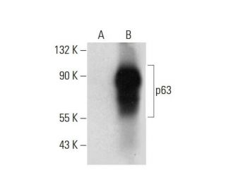 Anti-p63 Antibody (D-9) | SCBT - Santa Cruz Biotechnology