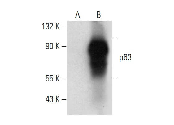 Anti-p63 Antibody (D-9) | SCBT - Santa Cruz Biotechnology