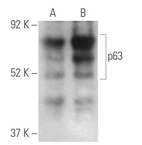 Anti-p63 Antibody (D-9) | SCBT - Santa Cruz Biotechnology