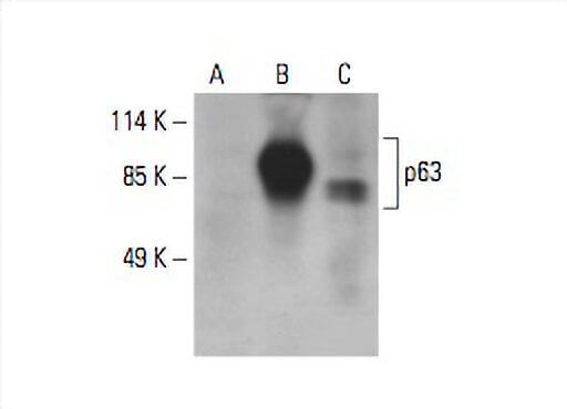 p63 Antibody (E-9) | SCBT - Santa Cruz Biotechnology