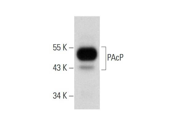 PAcP Antibody (C-12) | SCBT - Santa Cruz Biotechnology