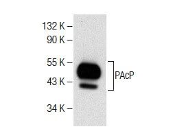 PAcP Antibody (PAP-1) | SCBT - Santa Cruz Biotechnology